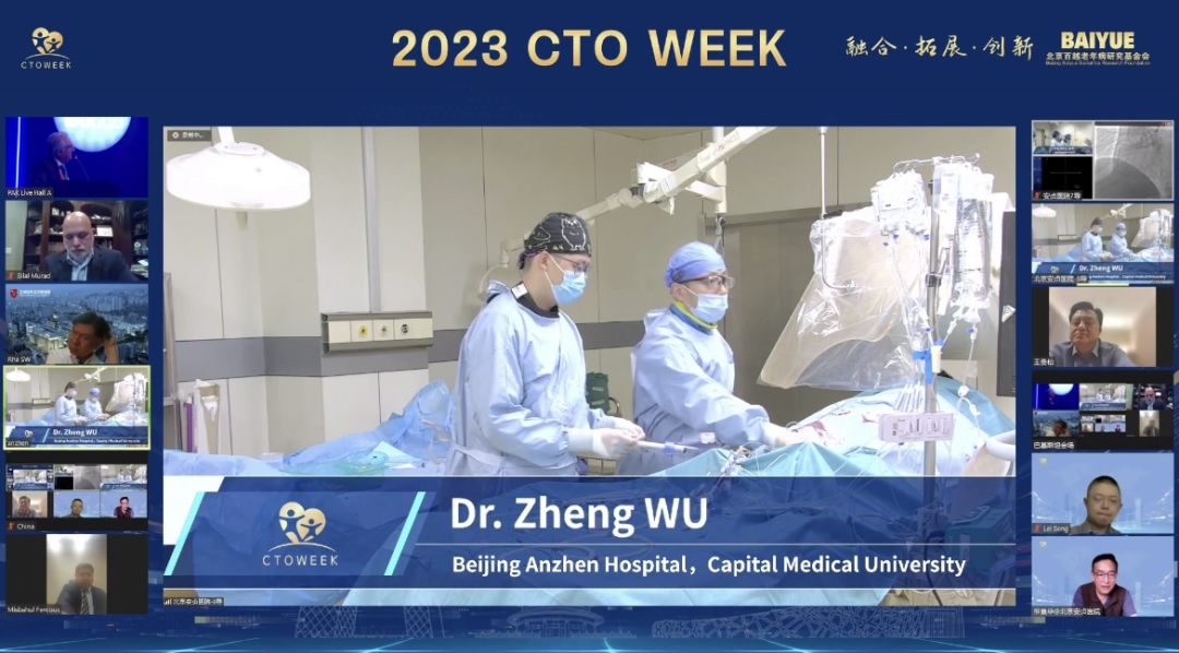 CTO WEEK 2023丨柳景华团队向巴基斯坦介入心脏病学会议现场成功转播一例高难度CTO-PCI手术 -- 严道医声网
