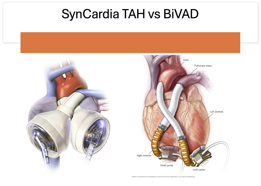 SynCardia全人工心脏在中国：从桥接至替代的项目蓝图 -- 严道医声网