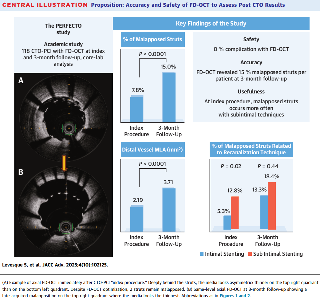 CTOCC开幕前预热｜OCT评估CTO-PCI效果有重大发现：要复查要后扩、不同技术都很好 -- 严道医声网