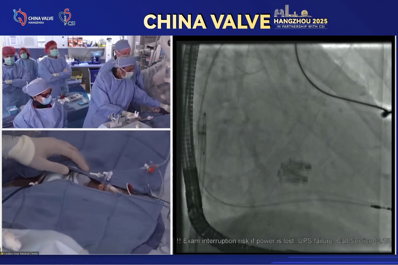 China Valve (HangZhou) 2026